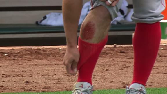 Trout suffers leg cramp, escapes serious injury - ABC7 Los Angeles