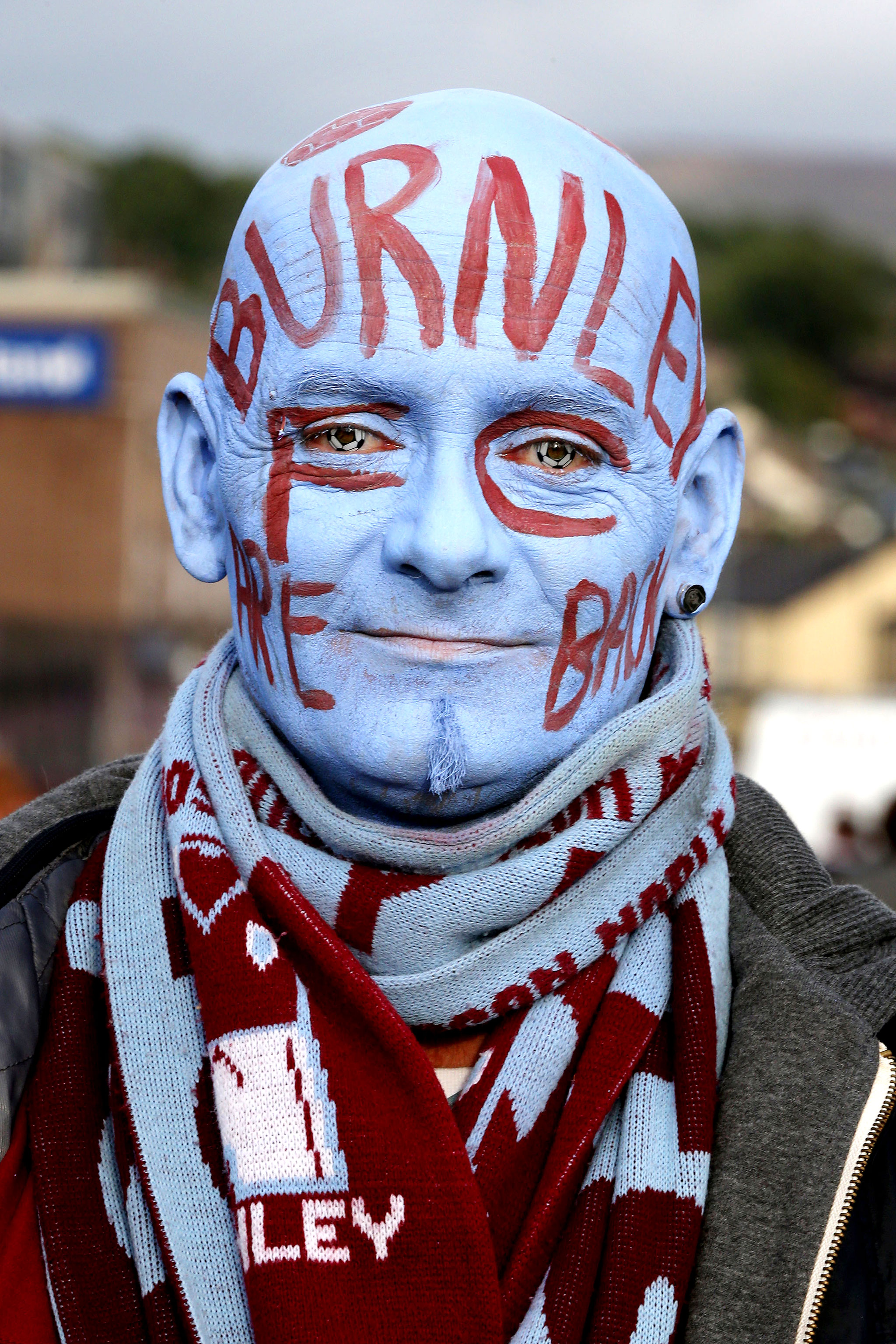 Burnley fan - Friday Funnies for August 22, 2014 - ESPN