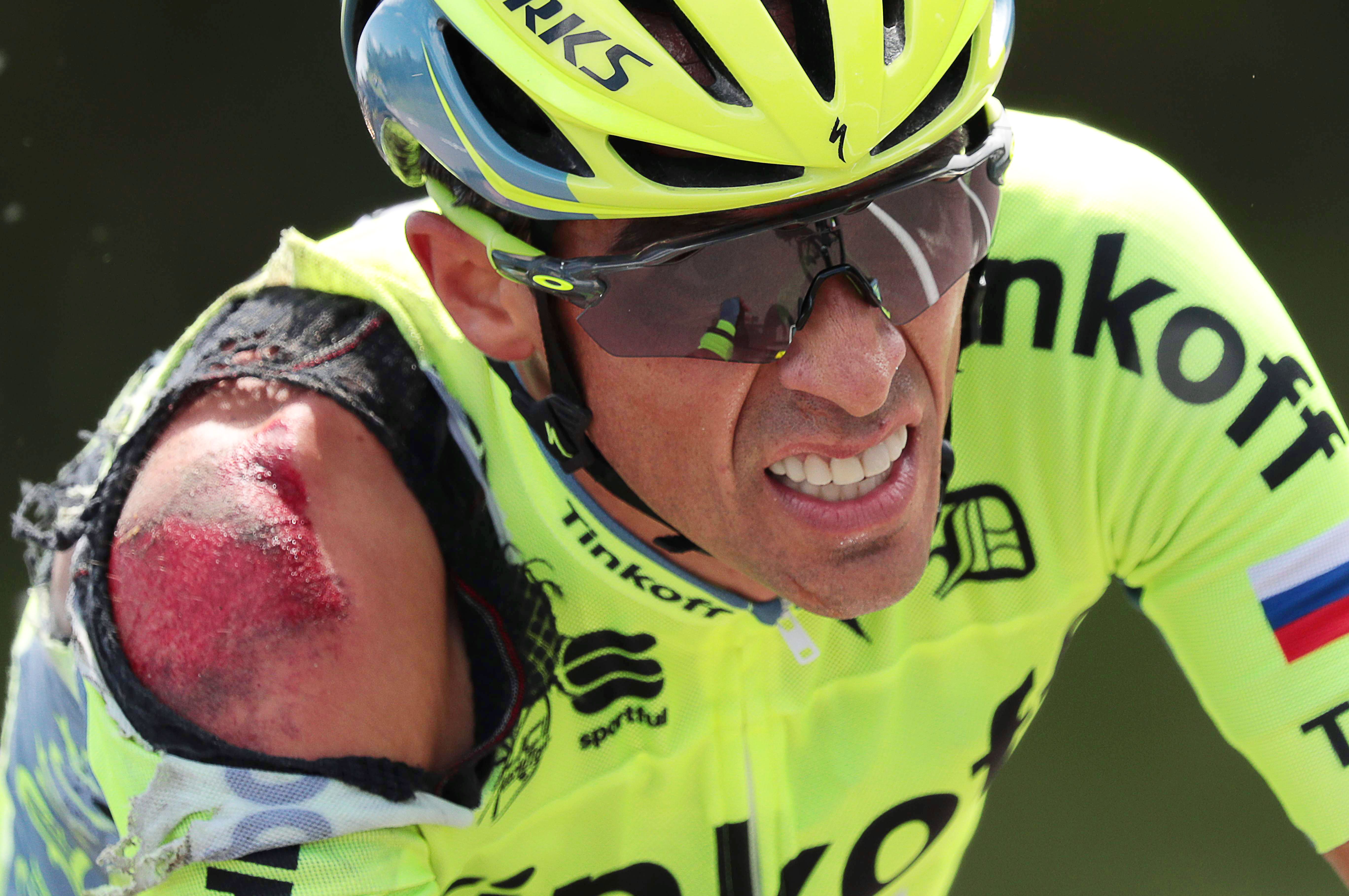 Gravel Rash - Photos: 2016 Tour de France - ESPN
