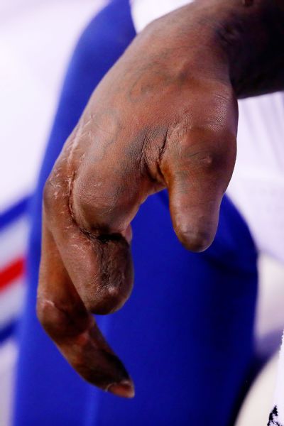 JPP reflects on Fourth of July accident that changed his life - ABC7 ...
